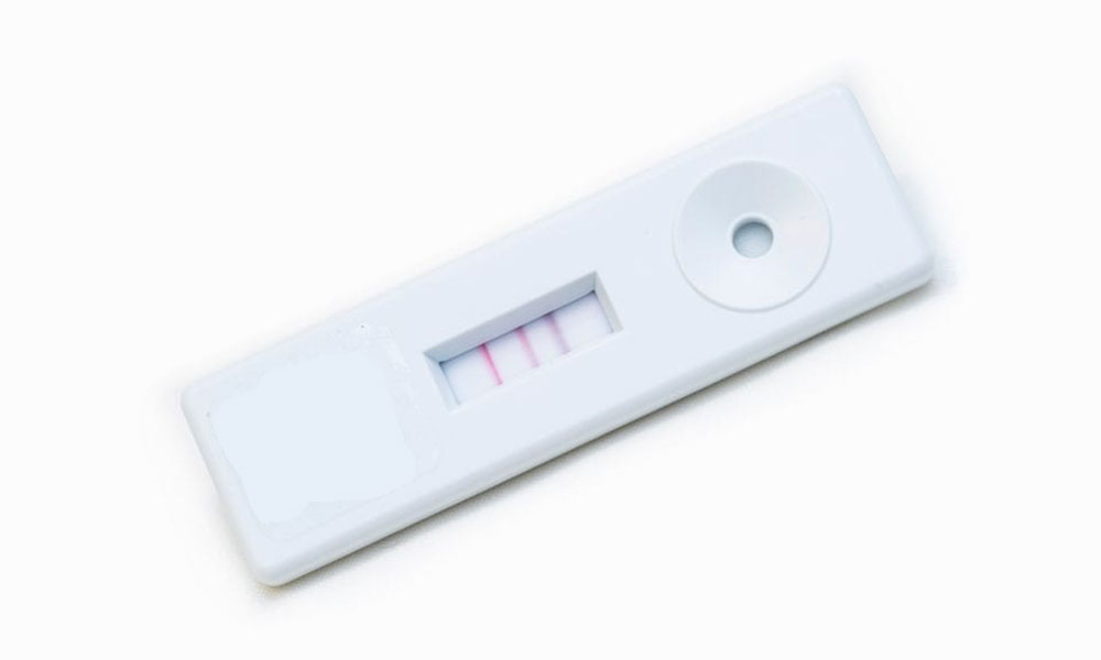 Rapid test kit approval urgently needed for mass screening
