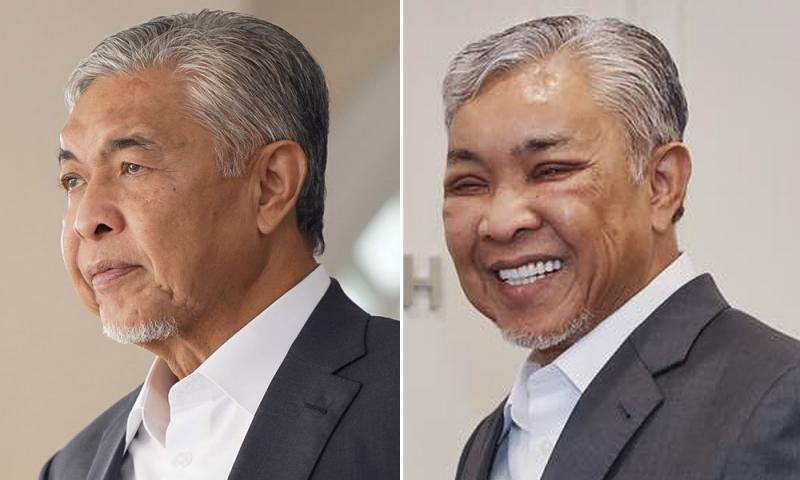 Zahid had surgery to fix obstructed vision - daughter